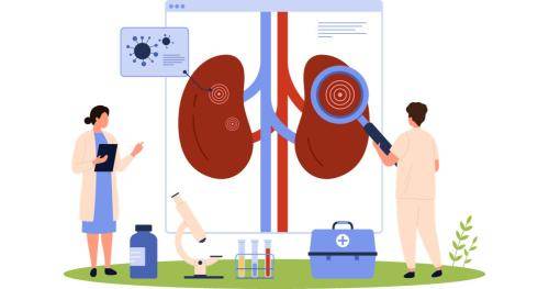 Renal Transplant Rejection - Iran Kidney Center