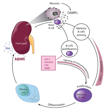Renal Transplant Rejection - Iran Kidney Center